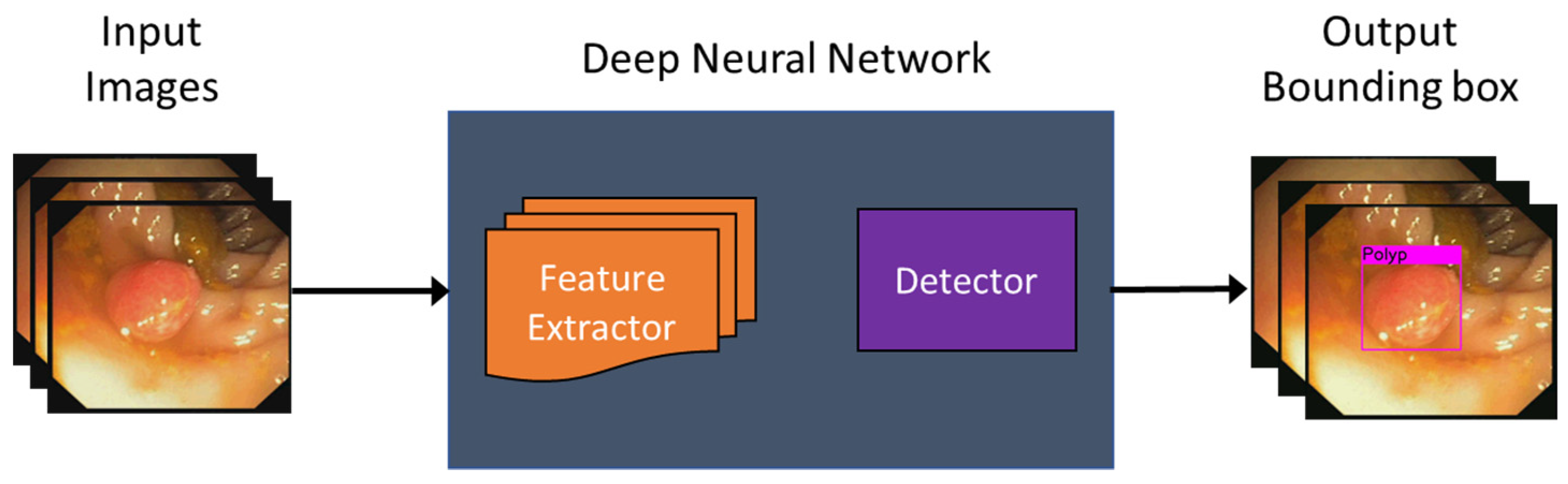 Automated Bowel Polyp Detection Based on Actively Controlled Capsule Endoscopy: Feasibility Study