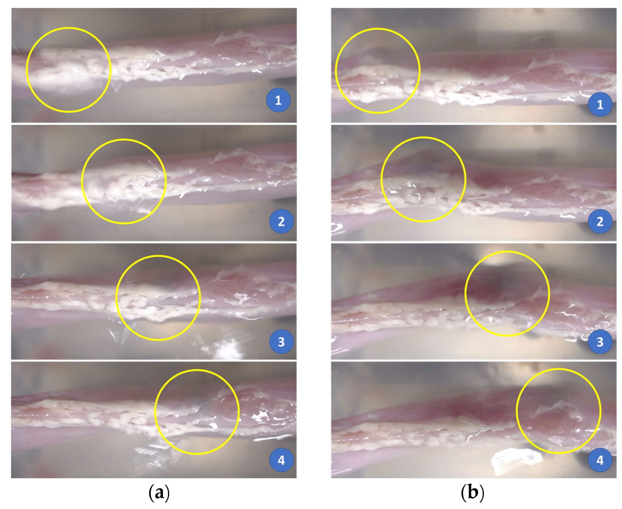 Automated Bowel Polyp Detection Based on Actively Controlled Capsule Endoscopy: Feasibility Study