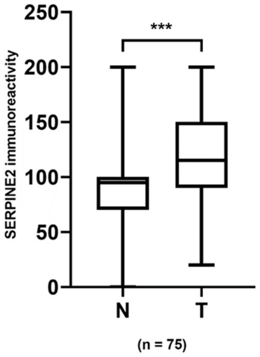 SERPINE2 Overexpression Is Associated with Poor Prognosis of Urothelial ...