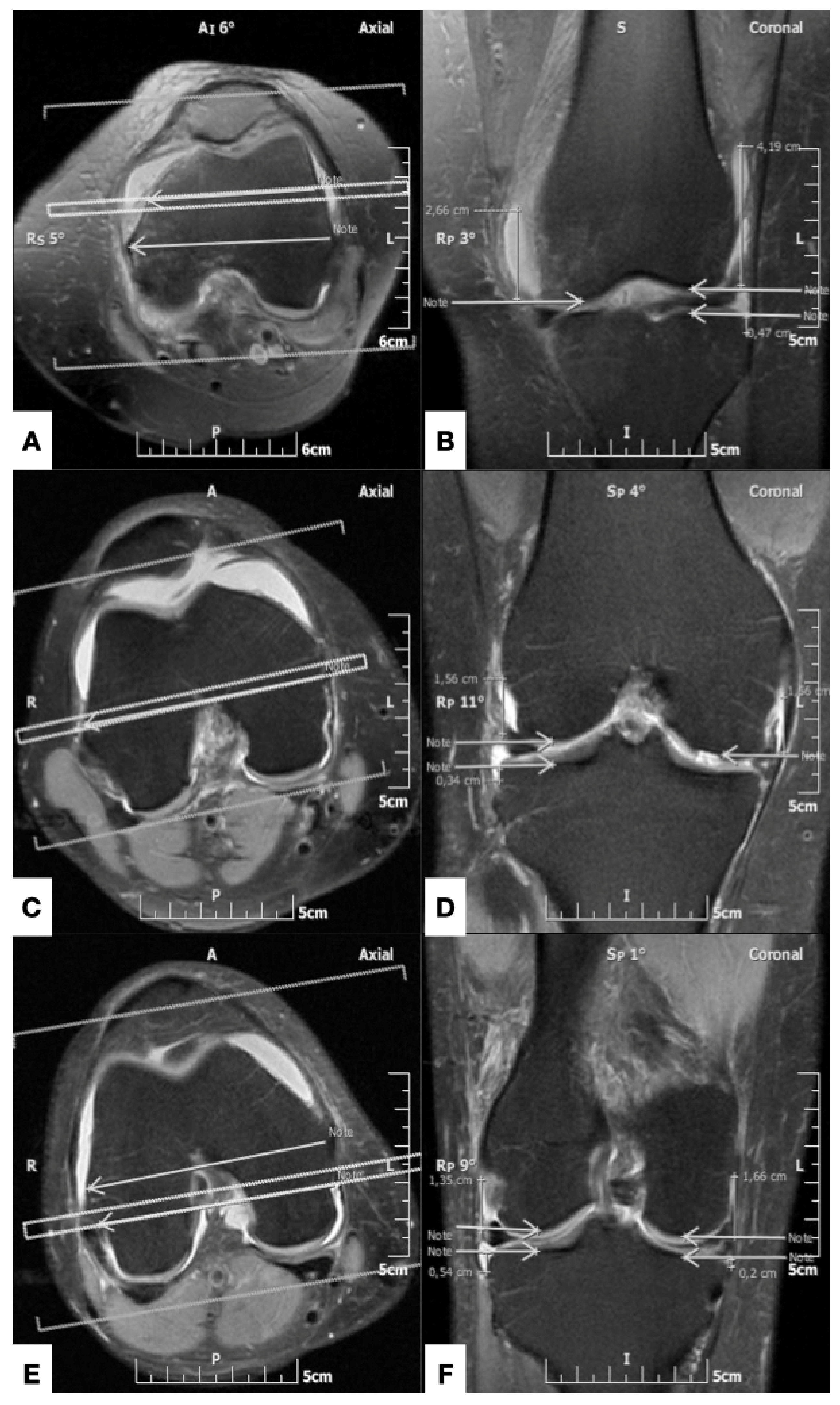 Knee Capsule Anatomy: An MR Imaging and Cadaveric Study