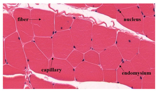 Diagnostics | Free Full-Text | Muscle Oxygenation Level Might Trigger ...