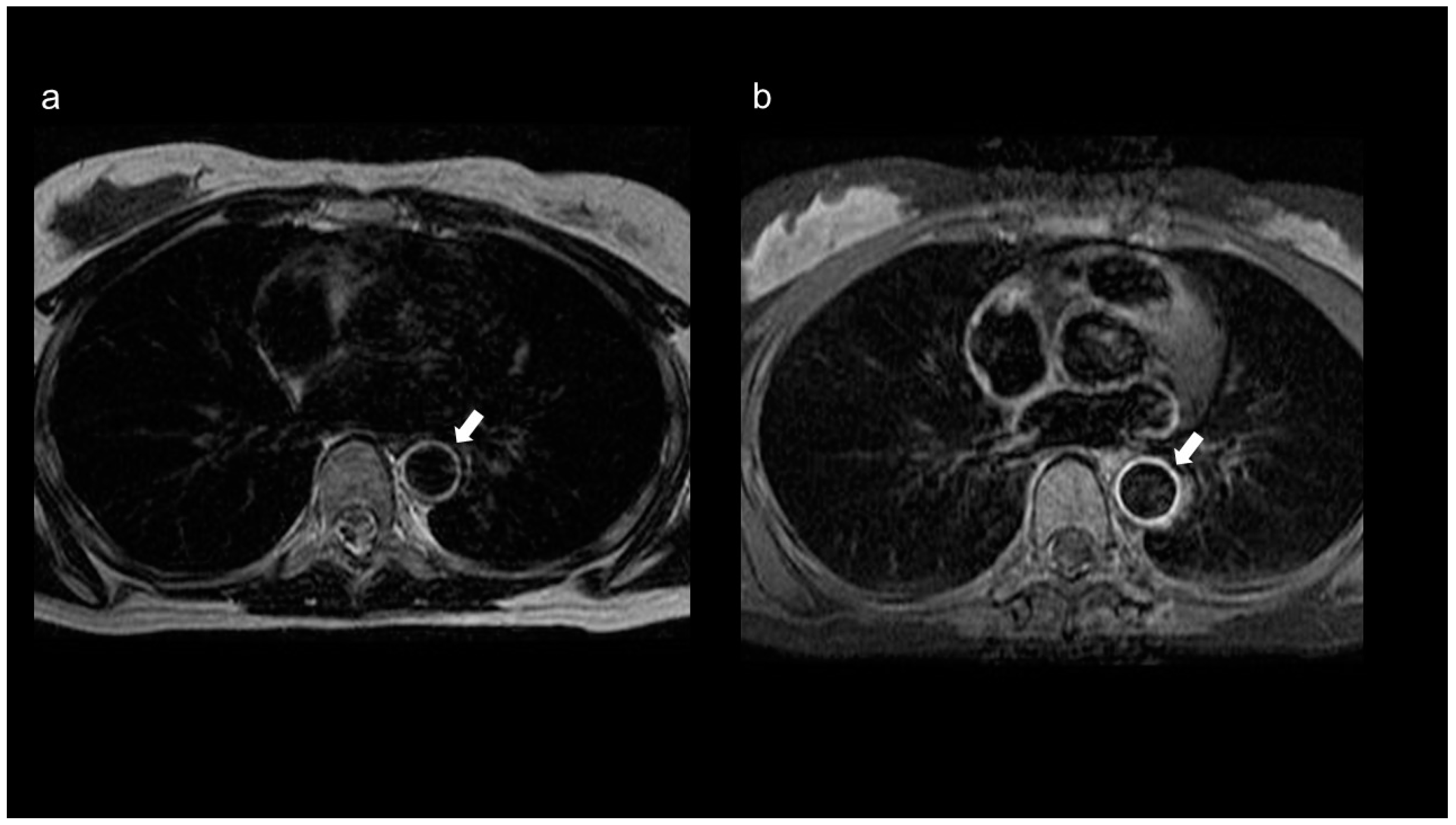 Vascular Imaging Techniques to Diagnose and Monitor Patients with ...