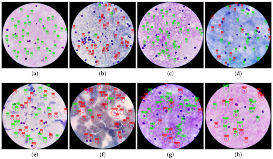 Diagnosing Malaria Patients with Plasmodium falciparum and vivax Using ...