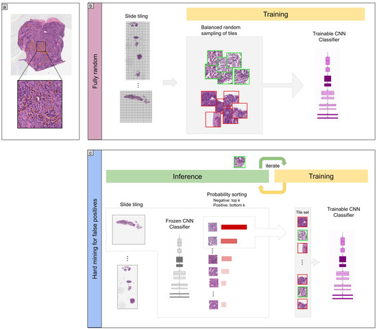 Deep Learning Models for Poorly Differentiated Colorectal ...