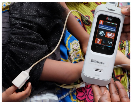 Performance of Automated Point-of-Care Respiratory Rate Counting versus ...