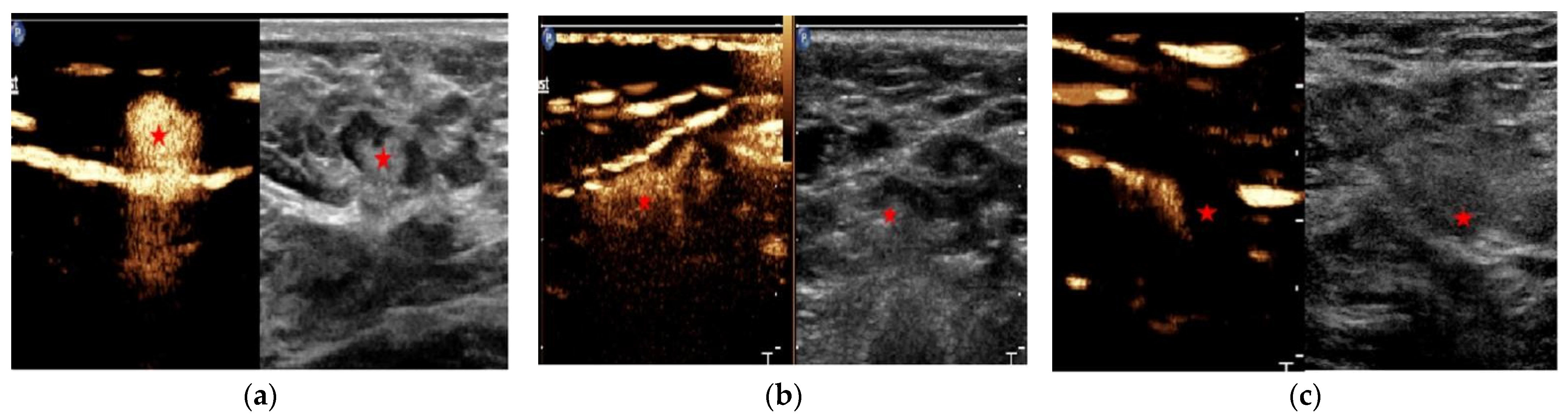 Diagnostics Free Full Text Contrast Enhanced Ultrasound For Precise