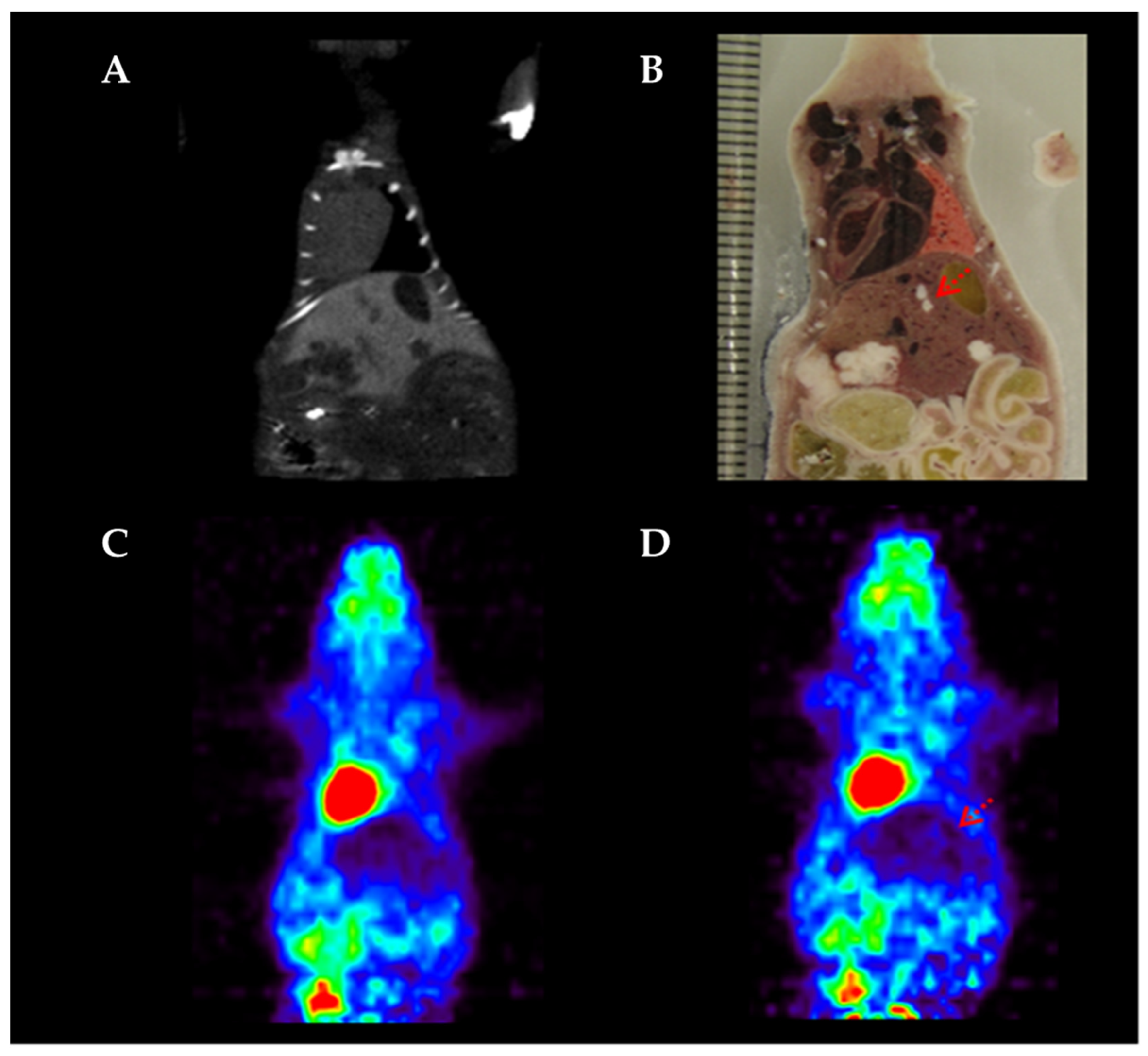 Low-Dose PET Imaging of Tumors in Lung and Liver Regions Using Internal ...