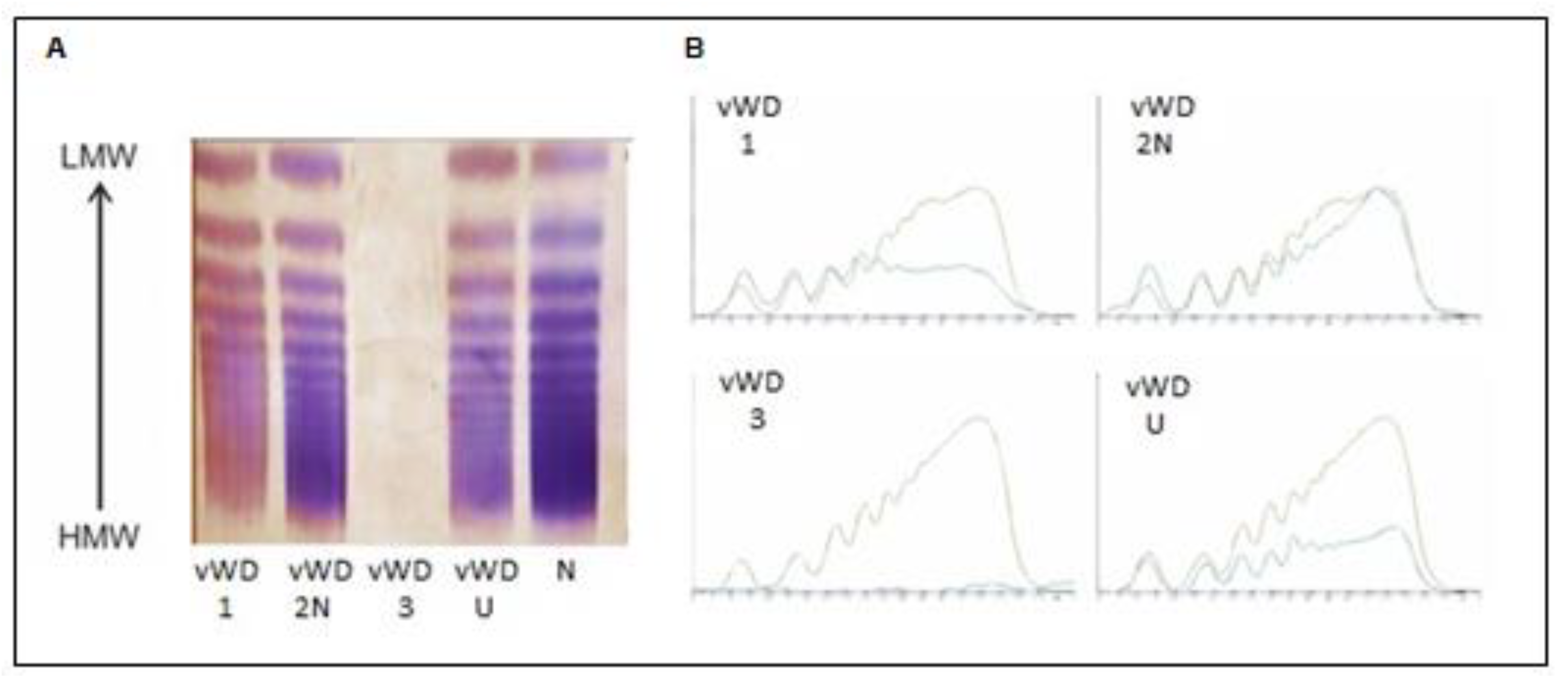 Diagnostics | Free Full-Text | Multimer Analysis of Von Willebrand ...
