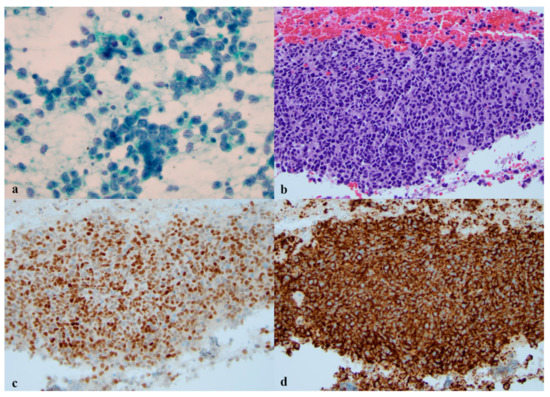 INSM1, a Novel Biomarker for Detection of Neuroendocrine Neoplasms ...