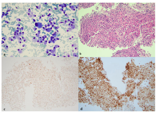 INSM1, a Novel Biomarker for Detection of Neuroendocrine Neoplasms ...