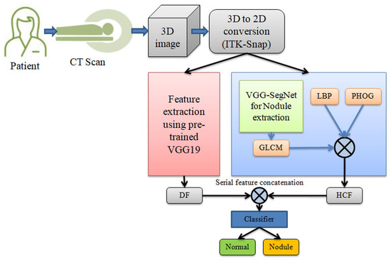 VGG19 Network Assisted Joint Segmentation and Classification of Lung Nodules in CT Images