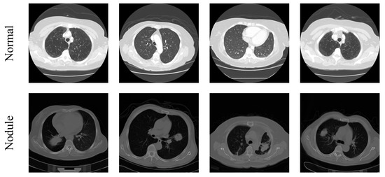 VGG19 Network Assisted Joint Segmentation and Classification of Lung ...