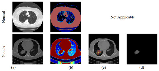 VGG19 Network Assisted Joint Segmentation and Classification of Lung ...