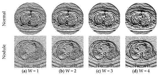 VGG19 Network Assisted Joint Segmentation and Classification of Lung ...