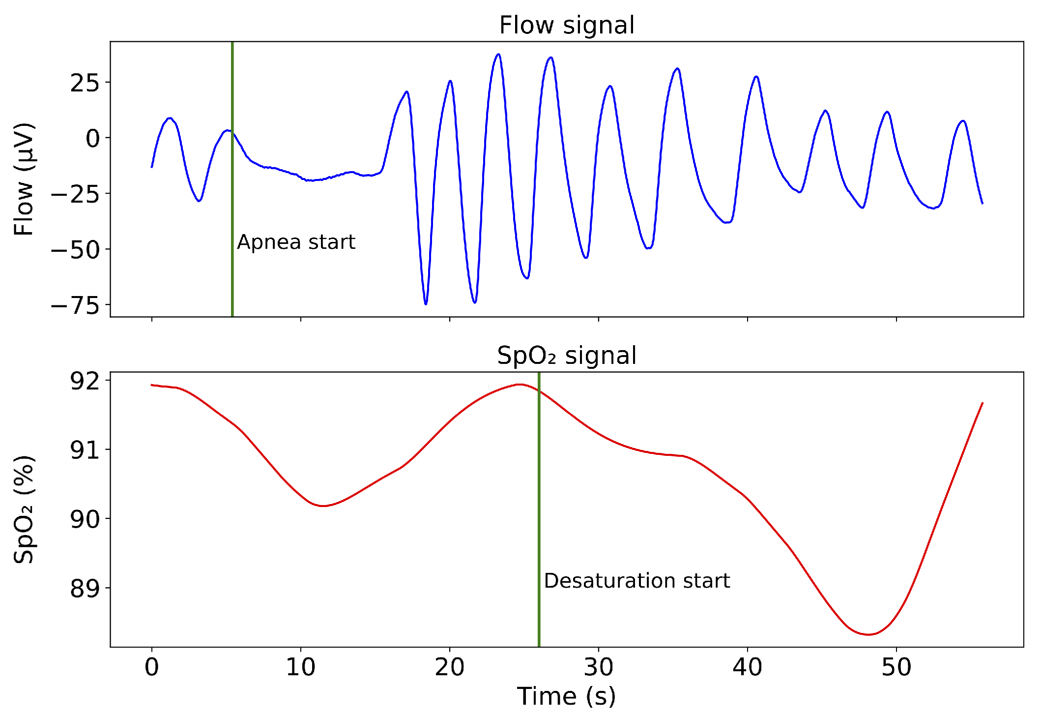 Apnea Detection in Polysomnographic Recordings Using Machine Learning ...