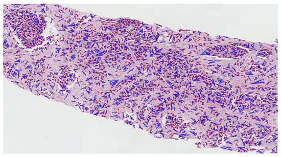 Cluster Analysis of Cell Nuclei in H&E-Stained Histological Sections of ...