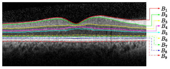 Diagnostics | Special Issue : Artificial Intelligence in Eye Disease