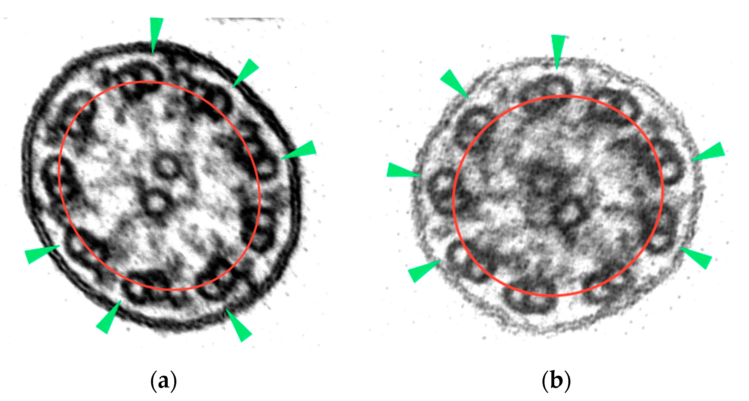 Axonemal Symmetry Break, a New Ultrastructural Diagnostic Tool for ...
