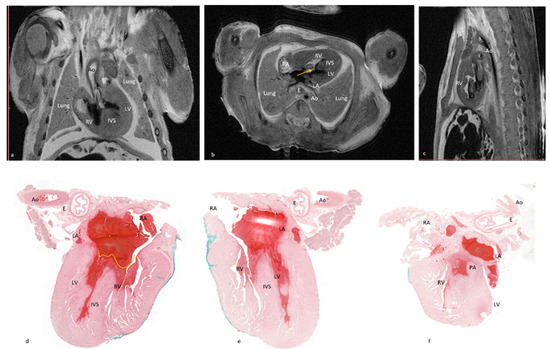 The Evaluation of the Four-Chamber Cardiac Dissection Method of the ...
