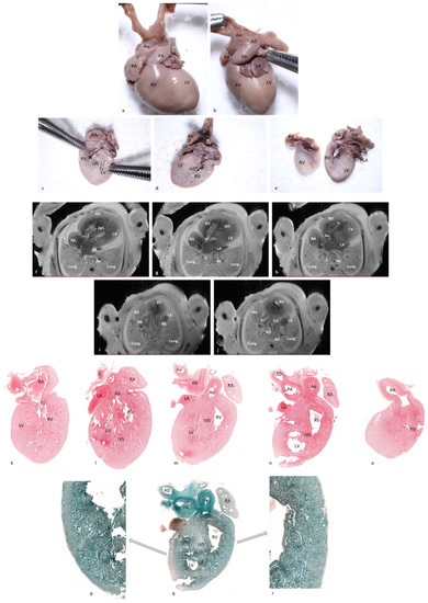 The Evaluation of the Four-Chamber Cardiac Dissection Method of the ...