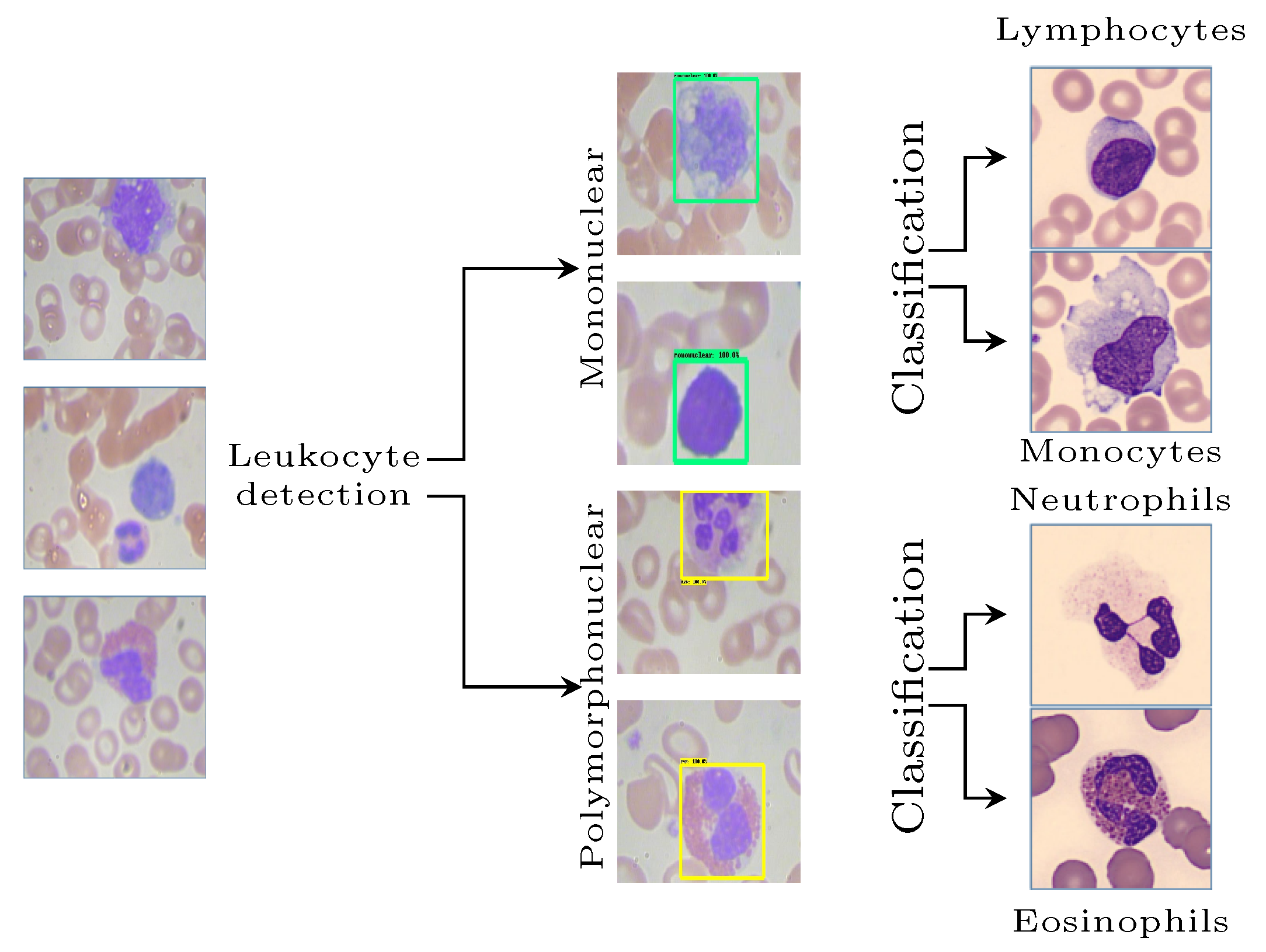 Classification Of White Blood Cells Using Capsule Networks Classification Of White Blood Cells Using Capsule Networks