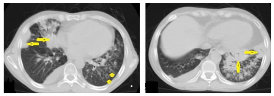 Diagnostics | Free Full-Text | The Diagnostic Deceiver: Radiological ...