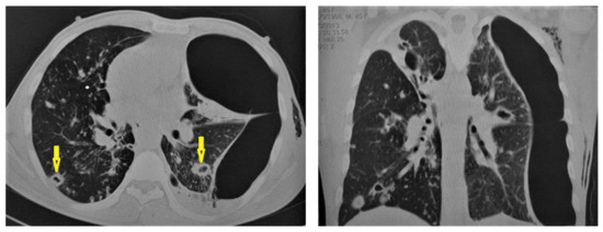 Diagnostics | Free Full-Text | The Diagnostic Deceiver: Radiological ...