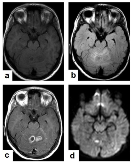 Diagnostics | Free Full-Text | The Diagnostic Deceiver: Radiological ...