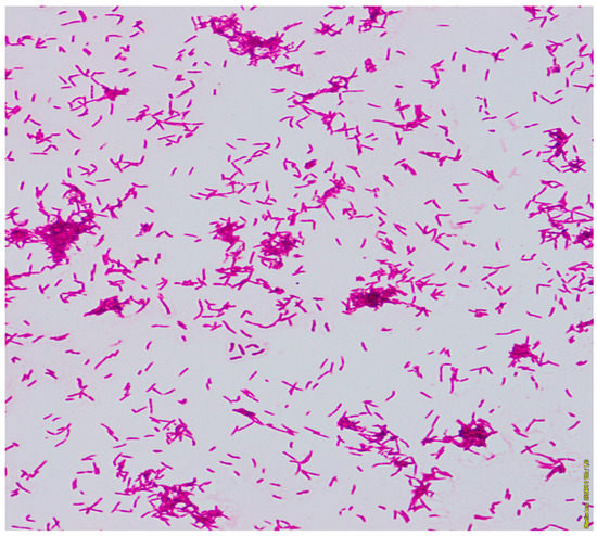 From NTM (Nontuberculous mycobacterium) to Gordonia bronchialis—A ...
