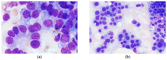 Surgical Site Cytology to Diagnose Spinal Lesions