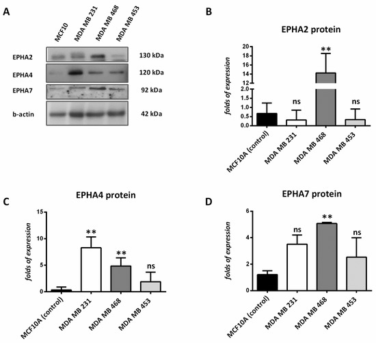 EPHA2, EPHA4, and EPHA7 Expression in Triple-Negative Breast Cancer