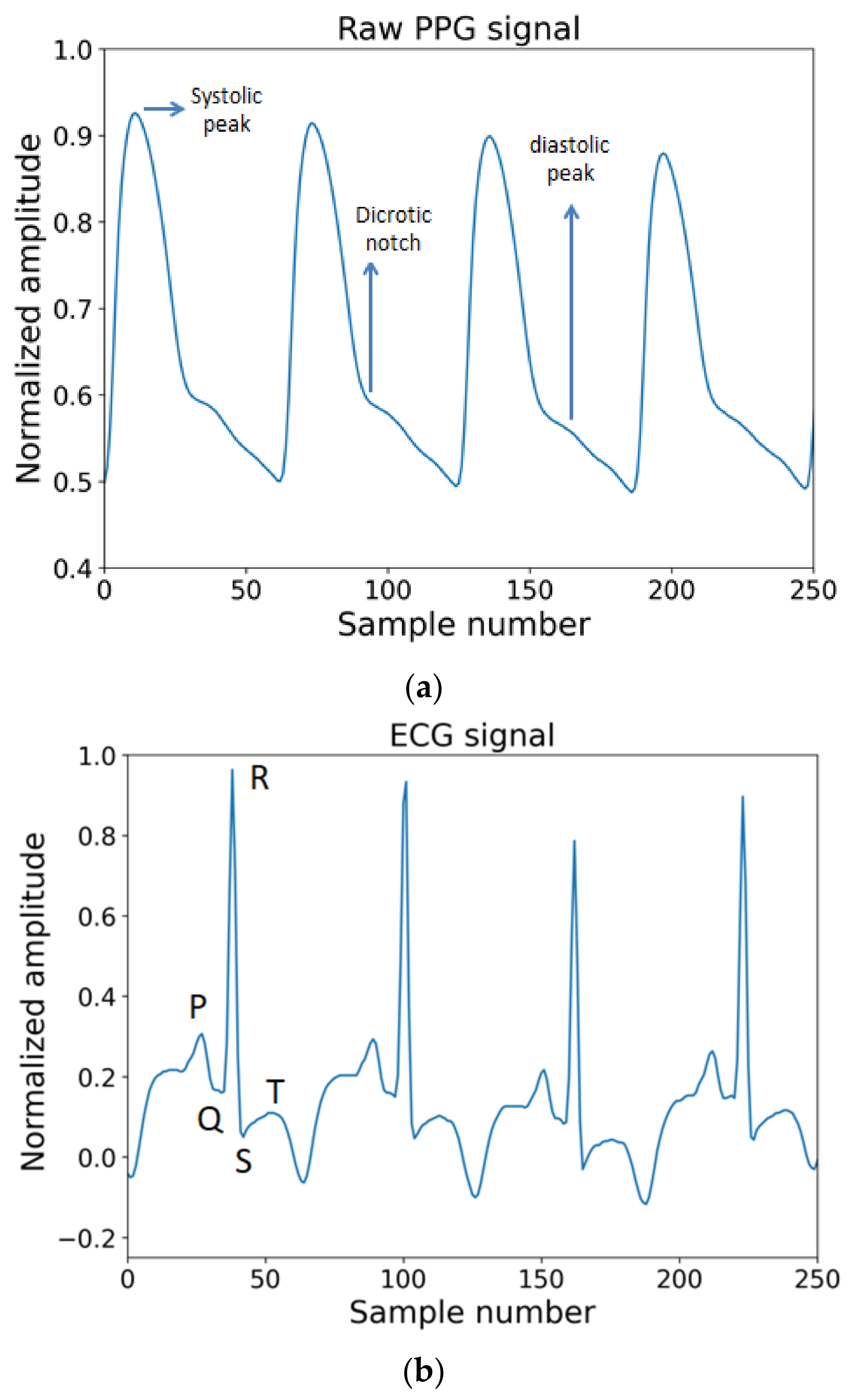 Cuffless Blood Pressure Measurement Using Linear and Nonlinear ...