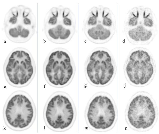 Advantages and Applications of Total-Body PET Scanning