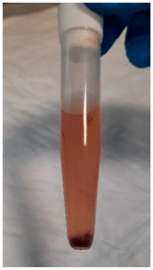 Impact of Macroscopic On-Site Evaluation (MOSE) on Accuracy of ...