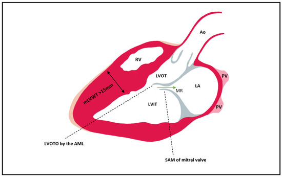 Anatomical-MRI Correlations in Adults and Children with Hypertrophic ...