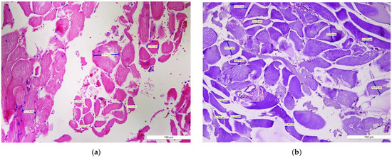 Unusual Case of Masseter Muscle Hypertrophy in Adolescence—Case Report ...