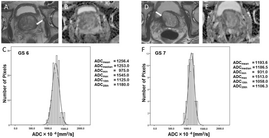 Medical Image Analysis