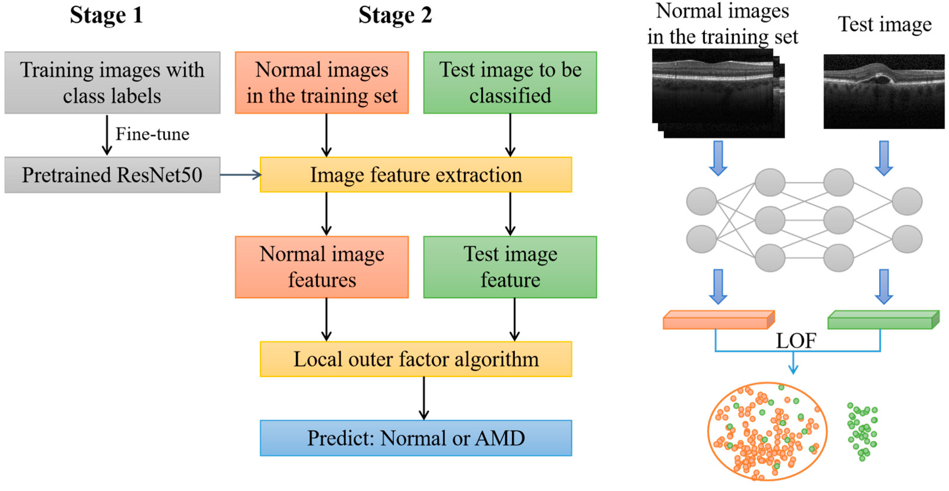 Automatic Detection of Age-Related Macular Degeneration Based on Deep Learning and Local Outlier ...