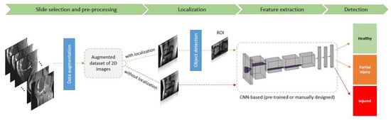 Knee Injury Detection Using Deep Learning on MRI Studies: A Systematic ...