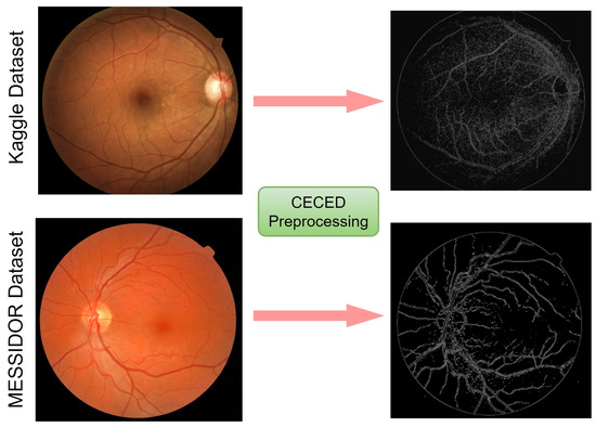 Identification of Diabetic Retinopathy Using Weighted Fusion Deep ...