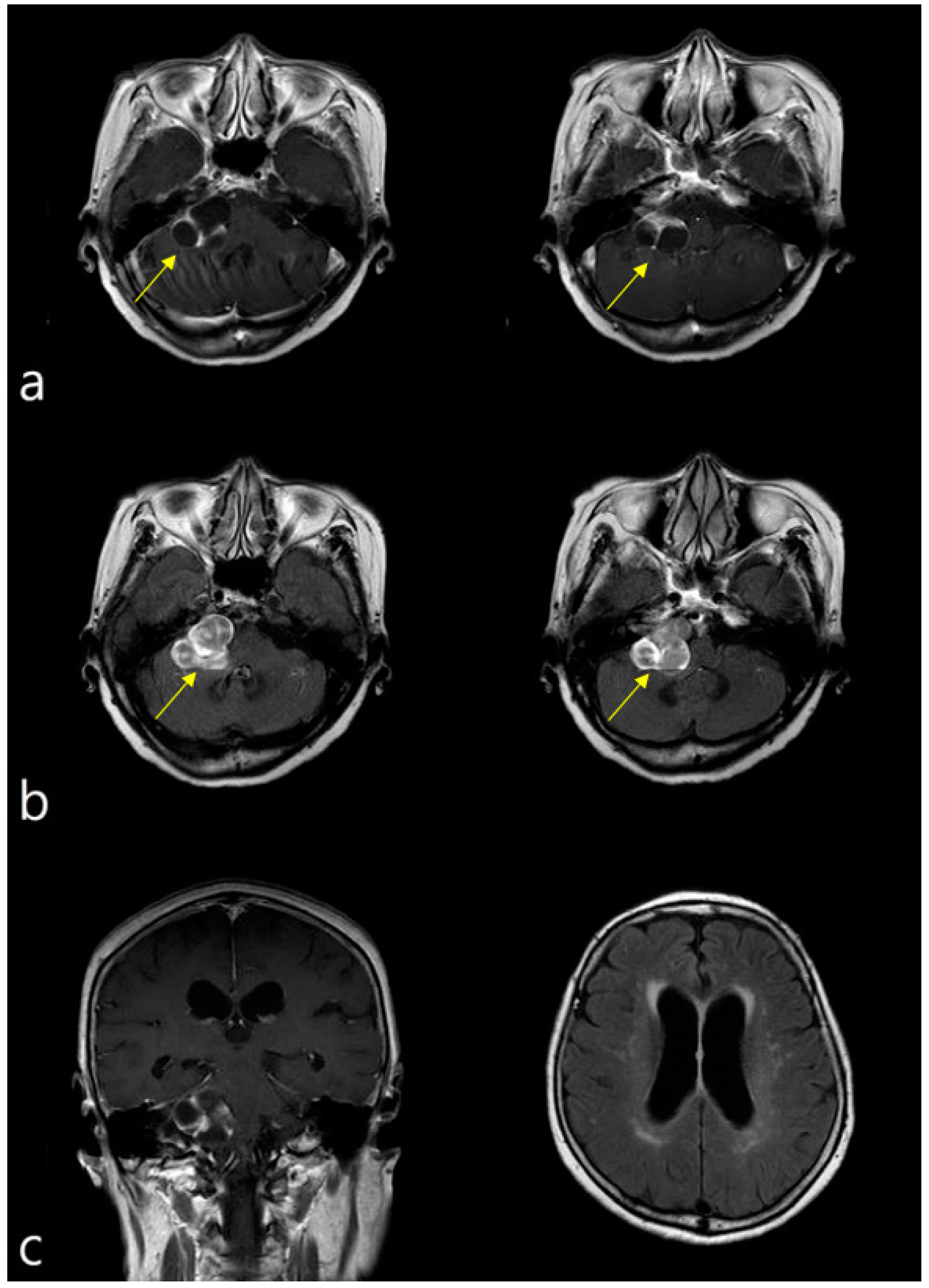 Diagnostic Value of Preoperative Electrodiagnostic Analysis in a ...