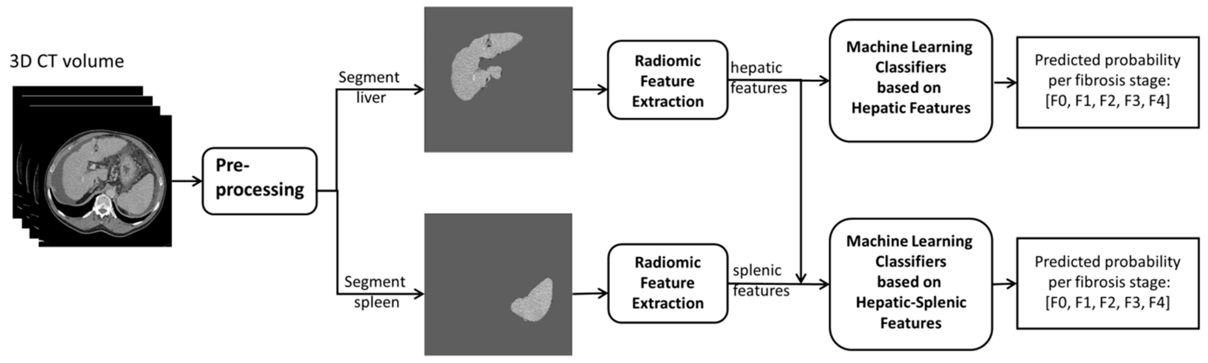 Combining Hepatic and Splenic CT Radiomic Features Improves Radiomic ...