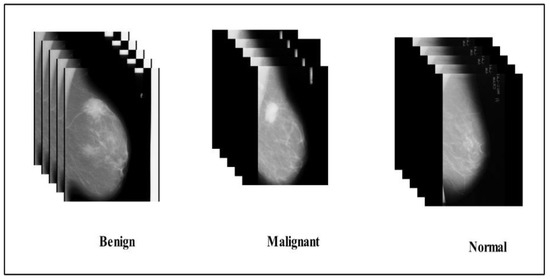 Diagnostics | Free Full-Text | Breast Cancer Mammograms Classification Using Deep Neural Network ...