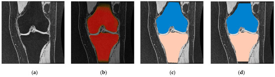 Diagnostics | Free Full-Text | A Comprehensive Survey on Bone Segmentation Techniques in Knee ...