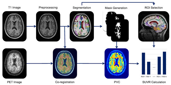Diagnostics | Free Full-Text | Development of Amyloid PET Analysis Pipeline Using Deep Learning ...