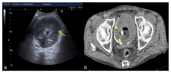 Common and Uncommon Errors in Emergency Ultrasound