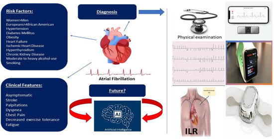 Current Advancement in Diagnosing Atrial Fibrillation by Utilizing Wearable Devices and ...