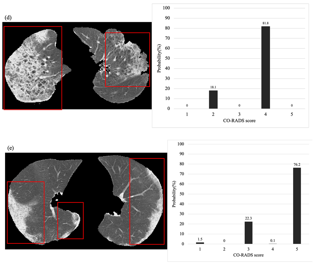 Comparison of CO-RADS Scores Based on Visual and Artificial ...