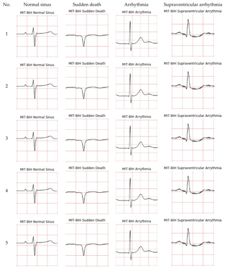 An Embedded System Using Convolutional Neural Network Model for Online ...