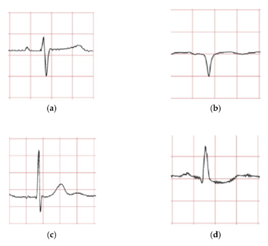 An Embedded System Using Convolutional Neural Network Model for Online ...